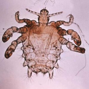 Läuse als Parasiten: Kopfläuse & ihre Verwandten